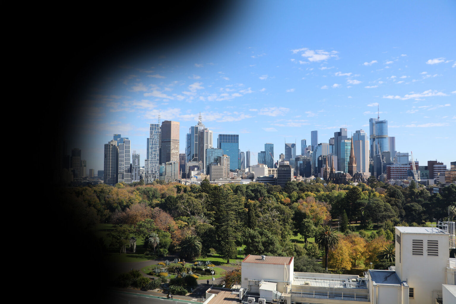 Glaucoma - East Melbourne Eye Group